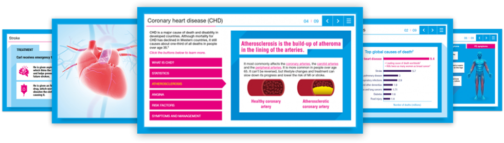 Coronary Heart Disease eLearning Course : 4pt Limited
